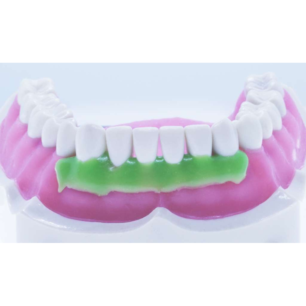 Clinical- General : M1040 Flowdam™ Flowable Dental Dam ...